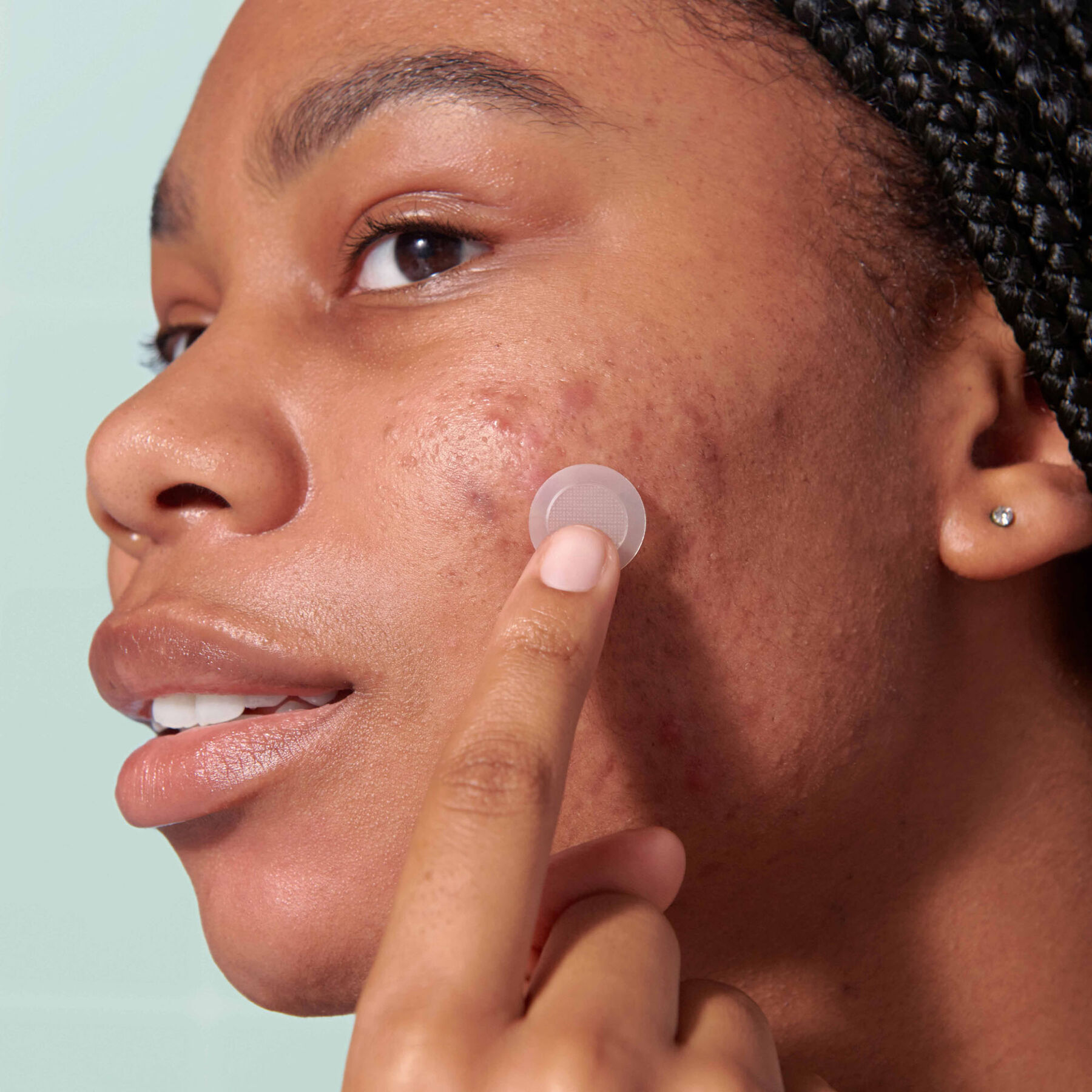 HSA Eligible Mighty Patch Micropoint for Blemishes - 8 ct. | HSA Eligible