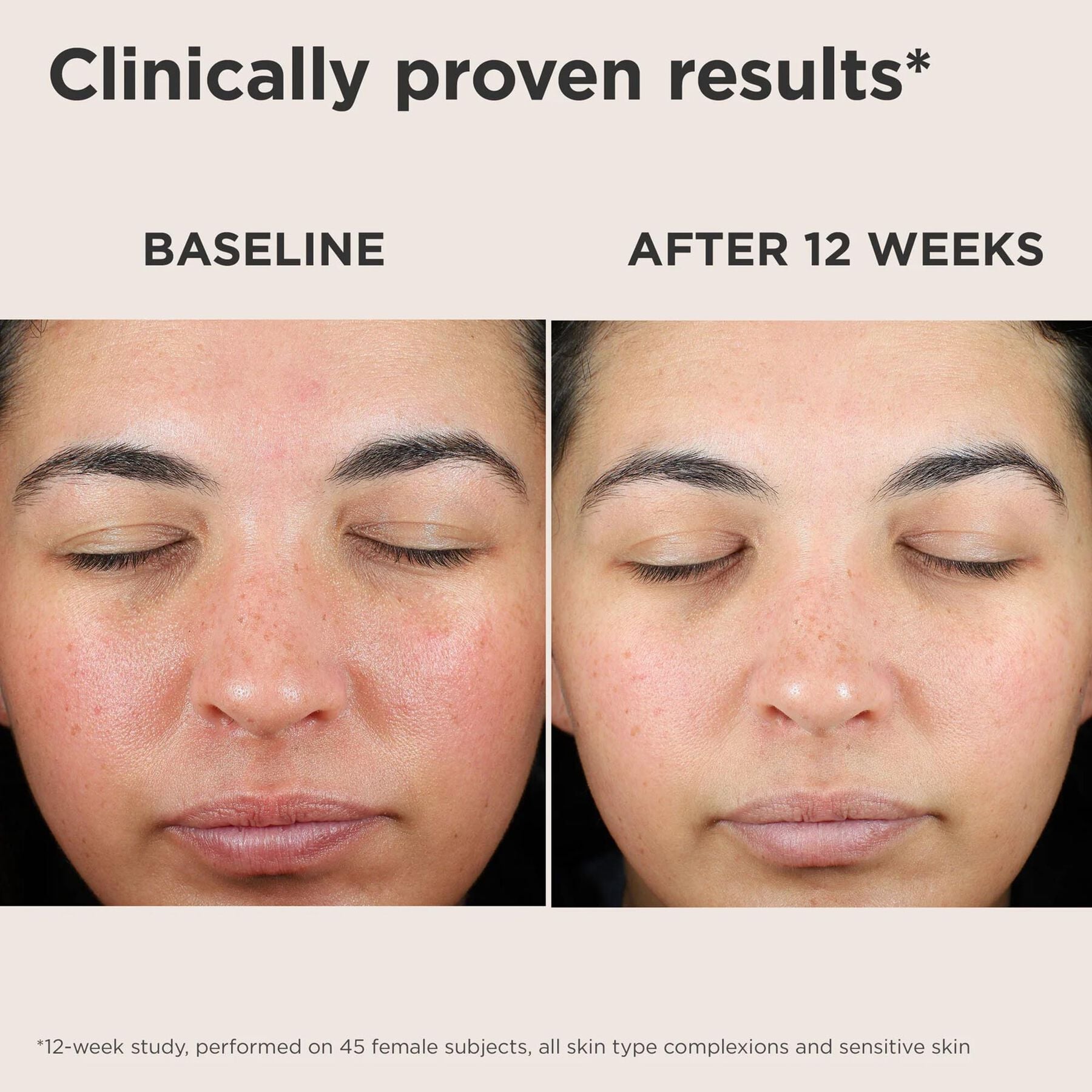 HSA Eligible EltaMD UV Skin Recovery Red Color Correcting Green Tint ...